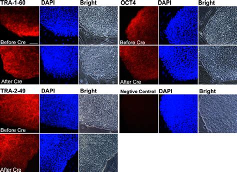 Expression Pluripotency Markers By Scap Ipscs In Vitro Embryonic Stem