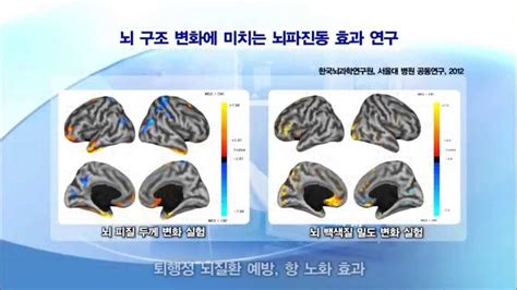 뇌교육 프로그램 뇌가 좋아지는 뇌파진동 Youtube