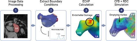 Workflow For Generating Patient Specific Models And Boundary Conditions