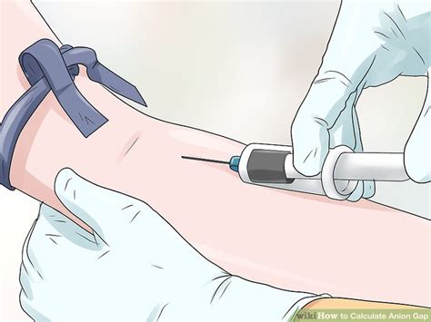 How To Calculate Anion Gap 12 Steps With Pictures WikiHow