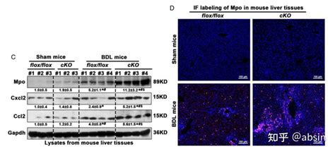 多色文献解读：肝胆多同病——胆汁淤积型肝炎 知乎