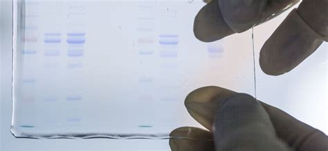 Choosing Between TAE Buffer And TBE Buffer For Agarose Gel Electrophoresis GoldBio