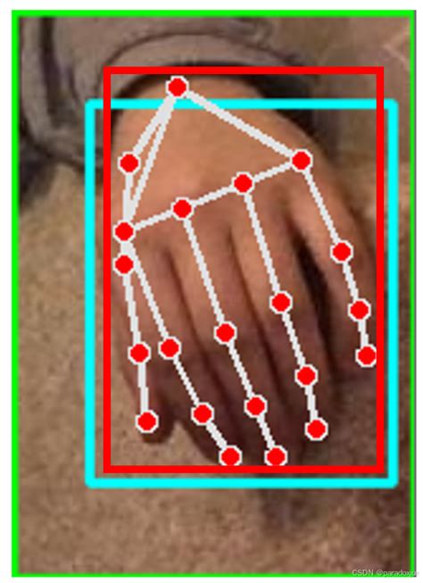 基于yolov8 Pose的手部关键点检测（1） 手部关键点数据集获取（数据集下载、数据清洗、处理与增强） Csdn博客