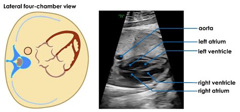 The Four Chambered Heart