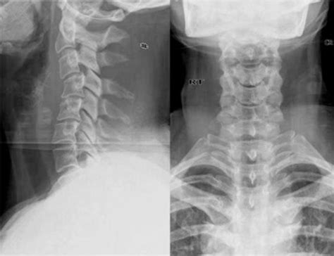 Differential Diagnosis Clicker Qs Flashcards Quizlet