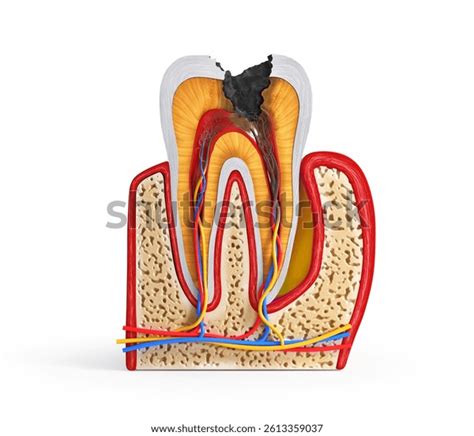 Human Tooth Structure Cross Section Scheme Stock Illustration