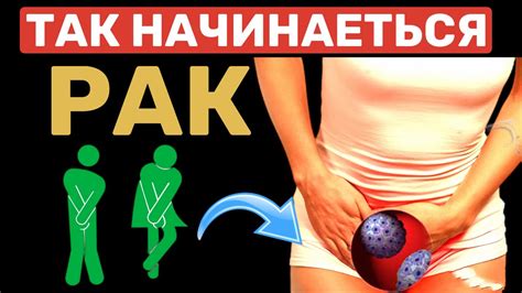 Внимание 12 распространённых признаков рака которые часто ИГНОРИРУЕТЬ Youtube