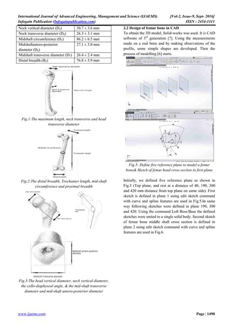 3 Dimensional Virtual Modelling Of Human Femur Bone With Prosthetic