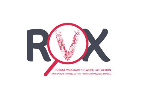 Slicerrvxliversegmentation 3d Slicer Extension For Interactive Liver Anatomy Segmentation