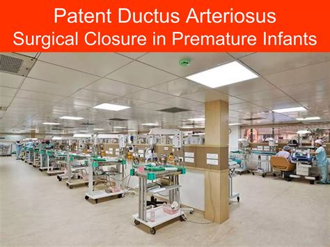 Surgical Closure Neonatal Pda Ppt