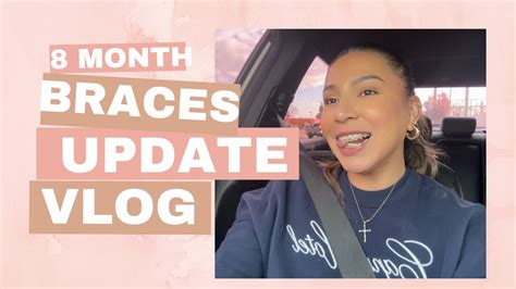 8 Month Braces Update Ortho Vlog Youtube