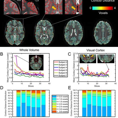 Quantification Of Spatial Specificity In Spiral Images Via Contour