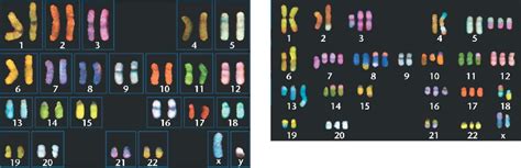 Cancerkaryotypehtml 1801 Cancerkaryotype