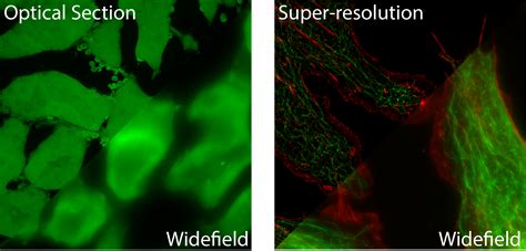 Which Fluorescence Microscopy Techniques Is Best For Me