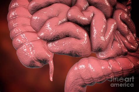 Human Appendix Photograph By Kateryna Kon Science Photo Library Fine Art America