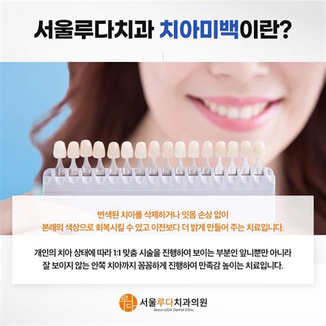 치아미백 서울루다치과