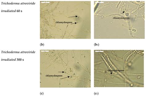 Effects Of Blue Light Laser Irradiation On The Enzymatic Activities And