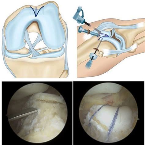 ГССҮТ ийн Спортын ГССҮТ ийн Спортын Гэмтлийн Төв