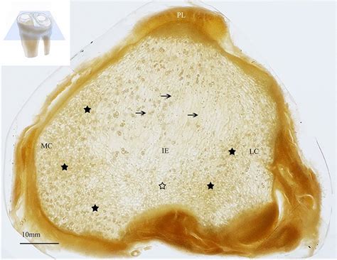 Horizontal Section Of Tibia Through The Epiphysis Lc Lateral Tibial
