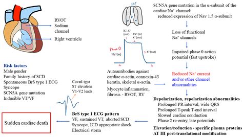 Brugada Syndrome Heart