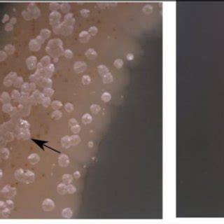 How To Inoculate The Three Compartment Plate With A Sterile Loop Download Scientific Diagram