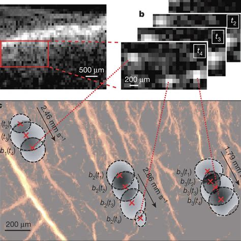 Pdf Ultrafast Ultrasound Localization Microscopy For Deep Super Resolution Vascular Imaging