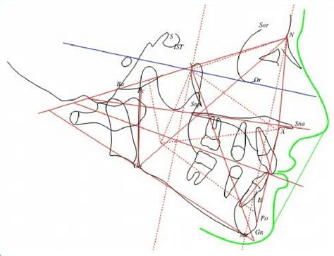 Angular And Linear Measurements Used In The Study Angular Measures
