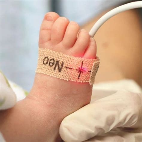 Disposable Neonatal Nellcor Spo2 Sensor At ₹ 150piece Malka Ganj