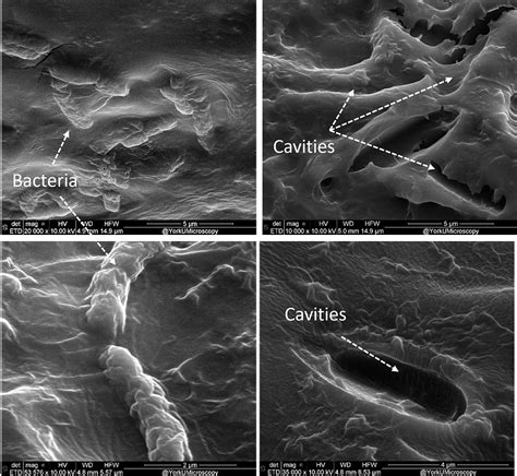 Alireza Zabihihesari Selective Capturing And Detection Of Bacteria