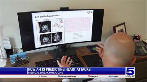 Medical Breakthroughs How Ai Is Predicting Heart Attacks