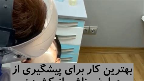 کشیدن دندان کودک