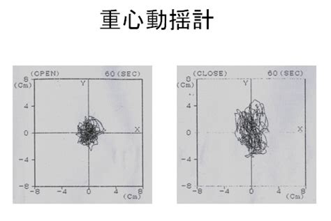 スタンダール症候群 東京医科大学 整形外科学分野
