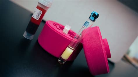 Pbmc Isolation Accurant Biotech