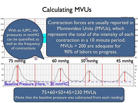 Basic Pattern Recognition Electronic Fetal Monitoring