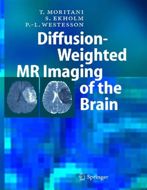 Diffusion Weighted Mr Imaging Of The Brain