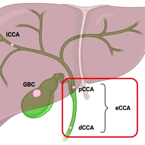 Schematic Representation Of The Anatomical Subgroups Of Biliary Tract
