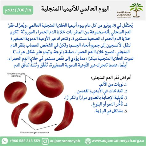 اليوم العالمي للأنيميا المنجلية جمعية التنمية الأهلية بالأوجام