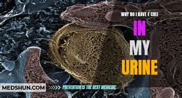 Understanding The Connection Between Interstitial Cystitis And Post Sex Pain MedShun