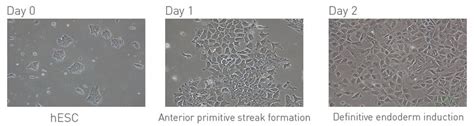 Culture Systems And Reagents For Definitive Endoderm Differentiation