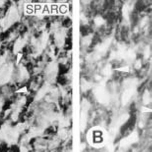 Expression Of SPARC And TSP In An Early CL Sections Were Double Download Scientific Diagram