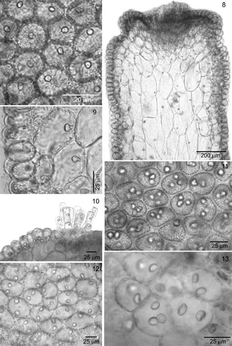 Details Of Corps En Cerise Cc 7 9 Laurencia Marilzae 7 Cortical Download Scientific