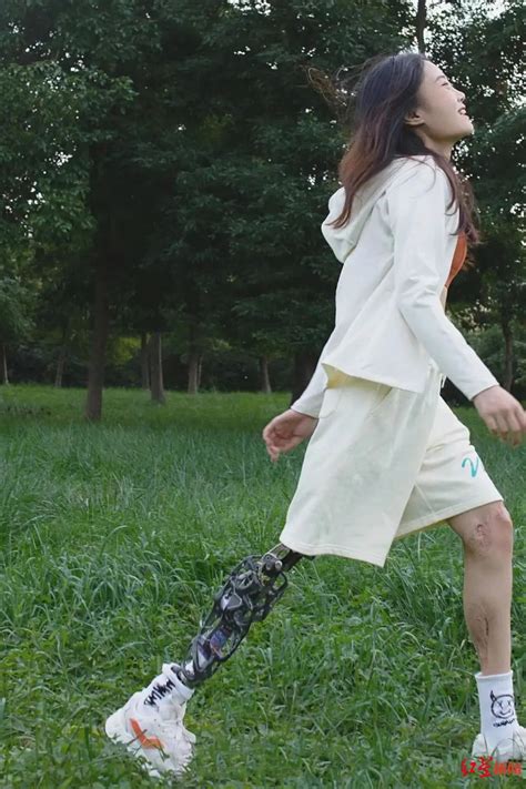 “钢腿女孩”，成为四川省人大代表！ 澎湃号·媒体 澎湃新闻 The Paper