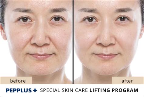 PicoBio PEPPLUS Skin Lifting Program Face Rejuvenating