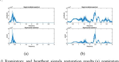 Figure 10 From Improved Denoising Method For Uwb Vital Signs Detection