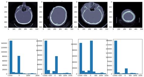 Automated Computer Aided Detection And Classification Of Intracranial