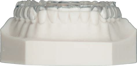 Tmj Splint Bottom Teeth At Tracy Lawson Blog
