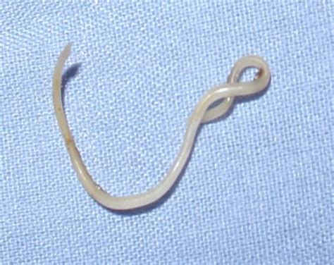 Endoparasites Flashcards Quizlet