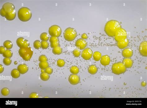 Bacteria Grown From Skin Smear Colonies Of Micrococcus Luteus And Staphylococcus Epidermidis On