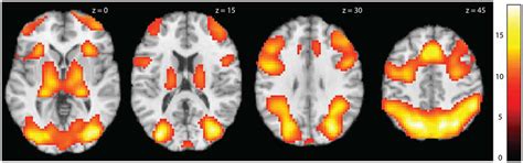 Activation Maps For Task Activations Across All Subjects Statistical Download Scientific