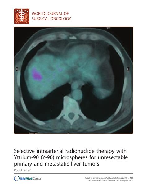 Pdf Selective Intraarterial Radionuclide Therapy With Yttrium 90 Y 90 Microspheres For